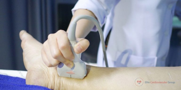 Arterial Duplex - Elite Cardiovascular Group