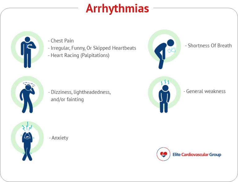 Arrhythmias - Elite Cardiovascular Group