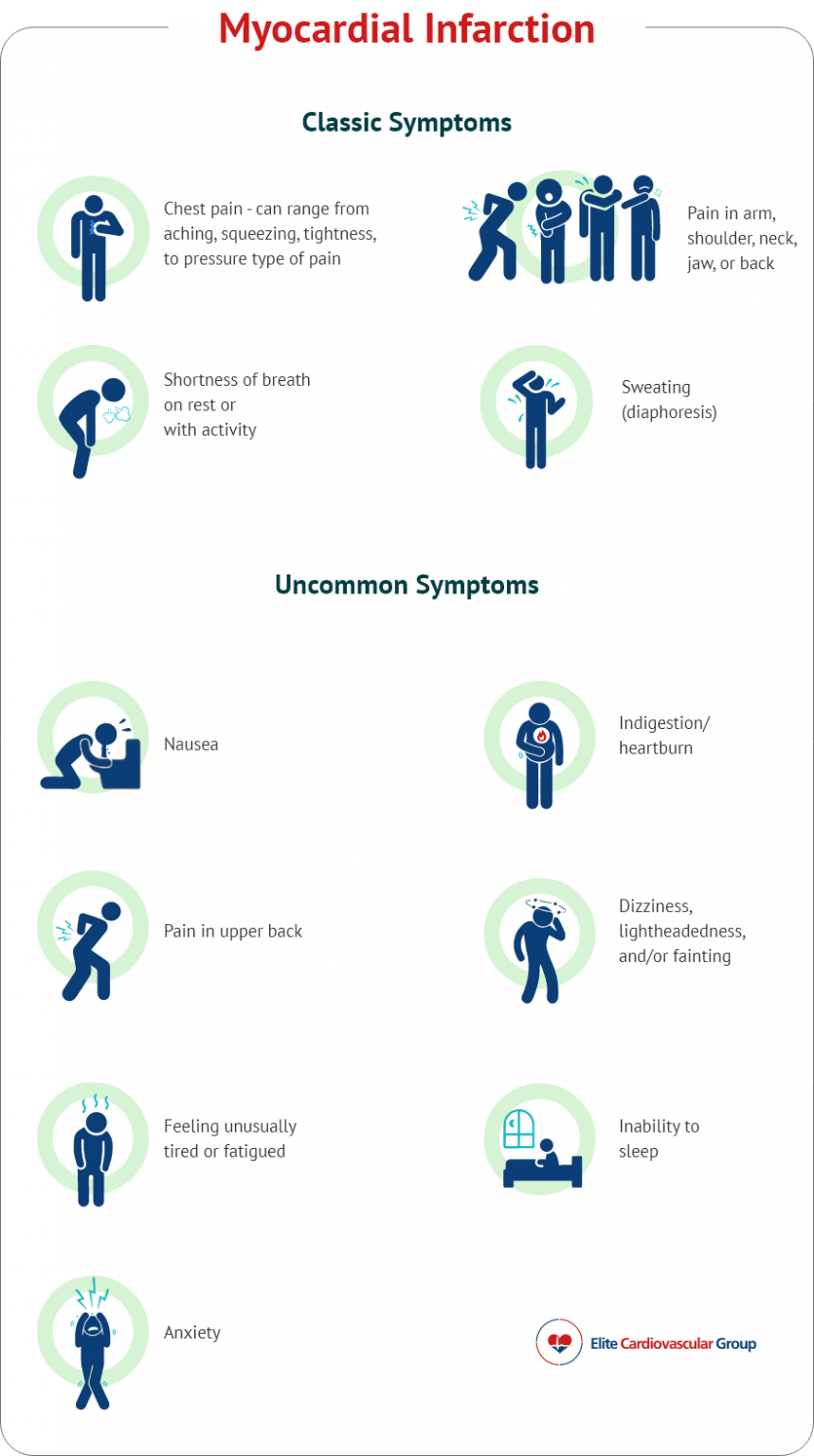 Myocardial Infarction (Heart Attack) - Elite Cardiovascular Group